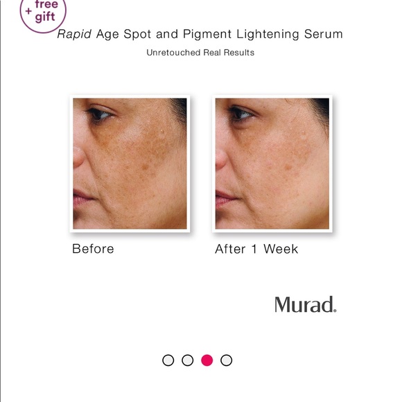 Murad | Skincare | Murad Rapid Age Spot Pigment Lightening Serum Oz ...